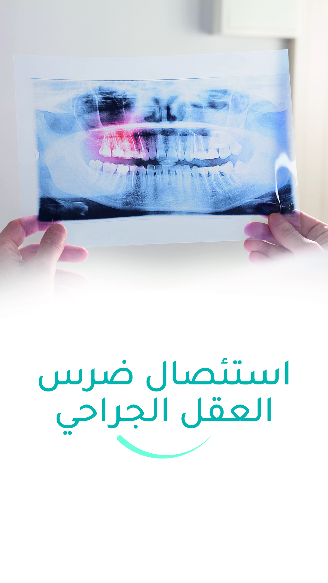الصفحة الرئيسية - True Smile Works